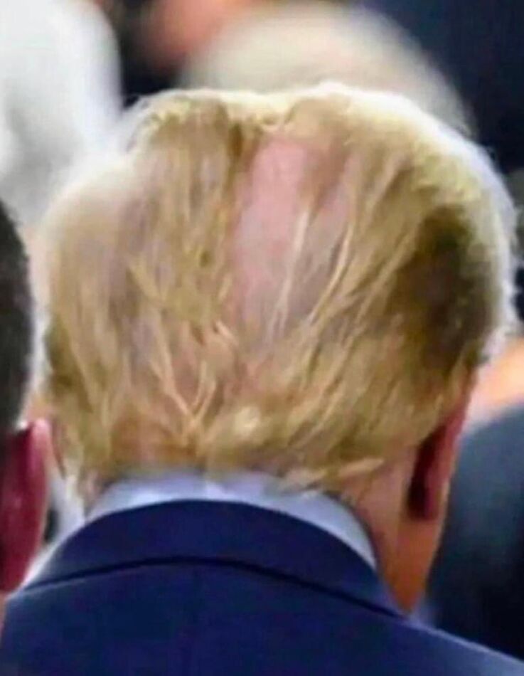 Today’s T***h: Trump’ head.